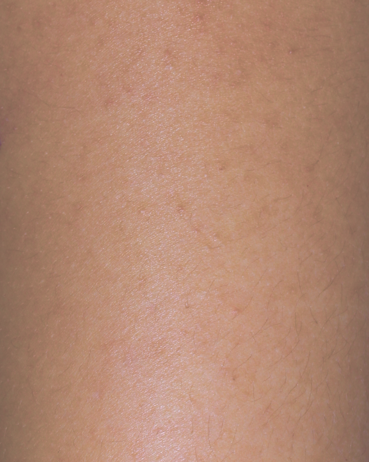 AHA/BHA Renewing Body Cream | Skinfix – Skinfix USA