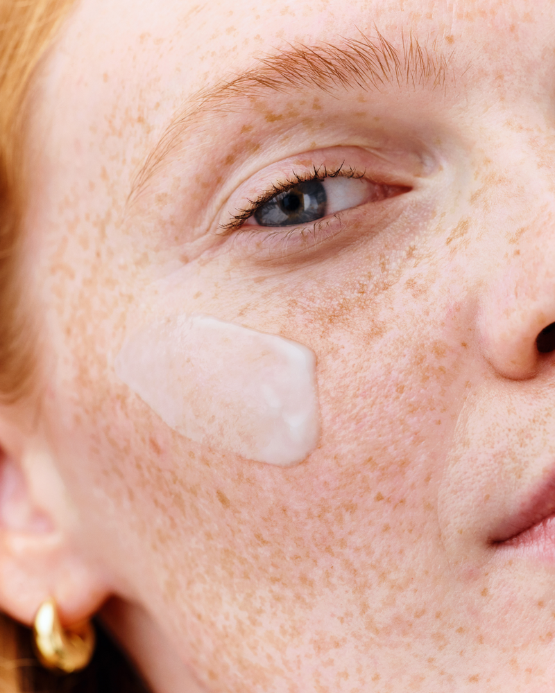 Adapinoid Gel | Skinfix – Skinfix USA