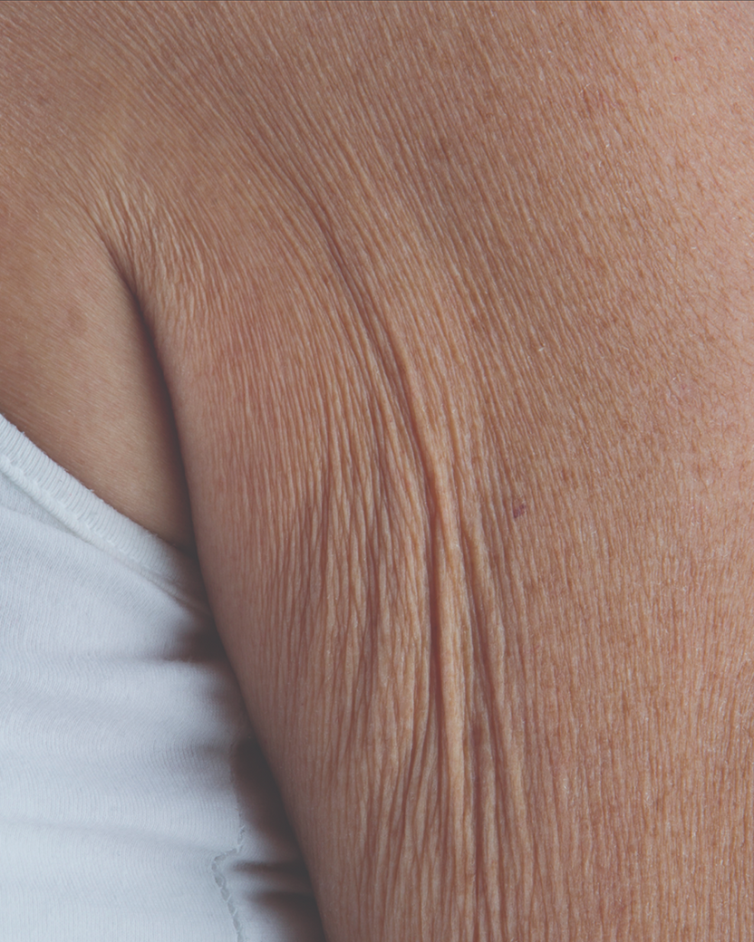 Glycolic Renewing Scrub | Skinfix – Skinfix USA