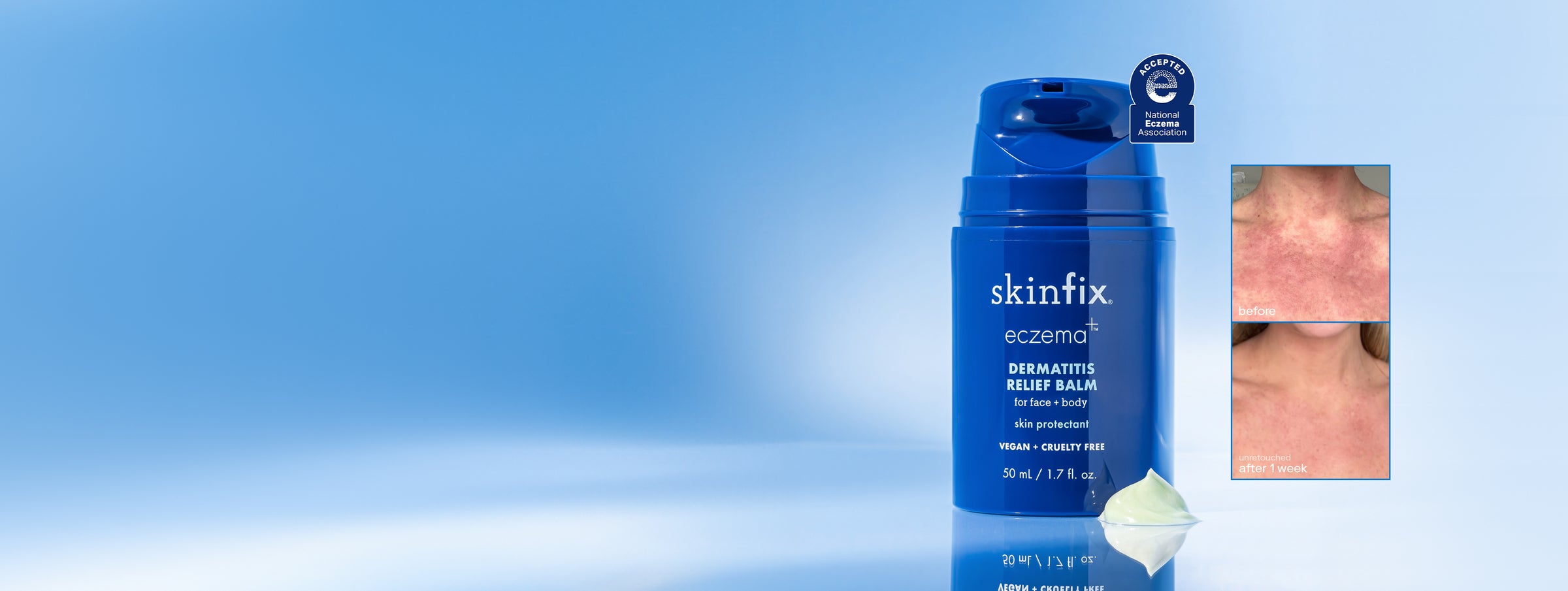 Skinfix - Total Skin Nerds – Skinfix USA