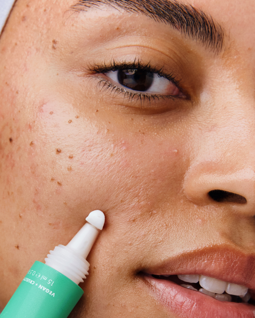 2% BHA Spot Treatment | Skinfix – Skinfix USA