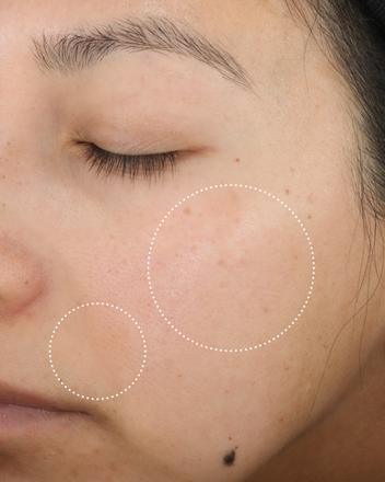 Triple Lipid-Peptide Cream | Skinfix – Skinfix USA