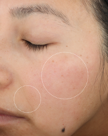 Triple Lipid-Peptide Cream | Skinfix – Skinfix USA