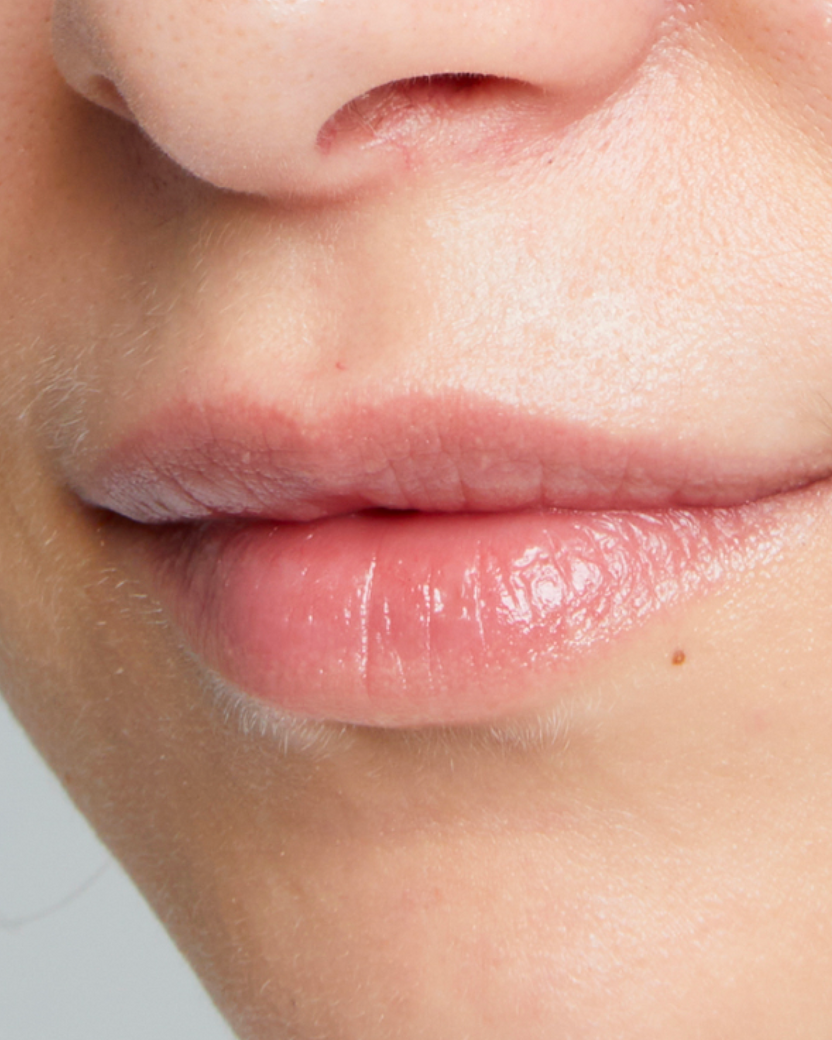 Triple Lipid Lip Treatment | Skinfix – Skinfix USA